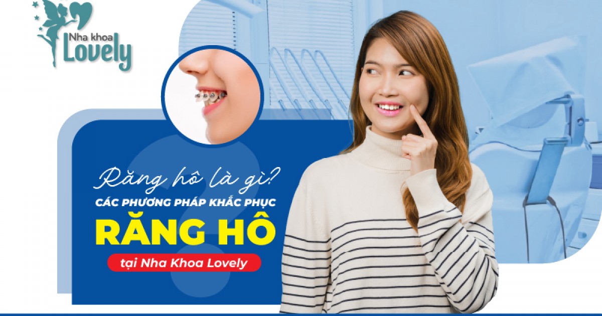 Nha Khoa Lovely - Quận 1 - Răng hô là gì? Các phương pháp khắc phục ...